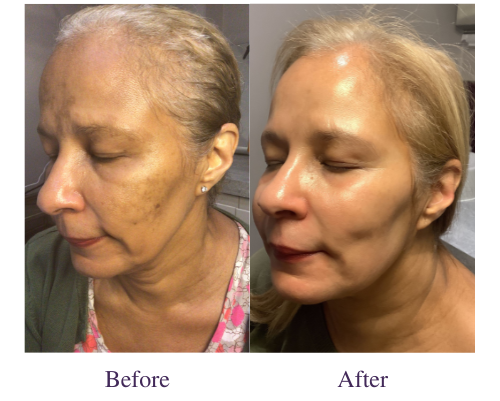 Pigmentation - Tessa Stevens