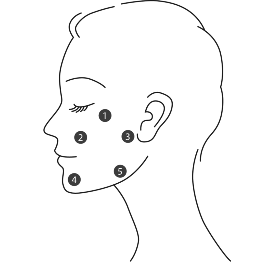 Profhilo - Tessa Stevens